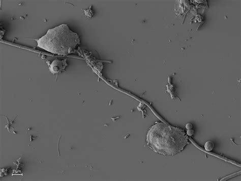 Parasites And Symbionts