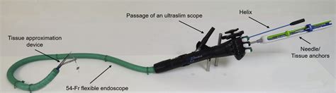 Endoscopic Plication Device Download Scientific Diagram