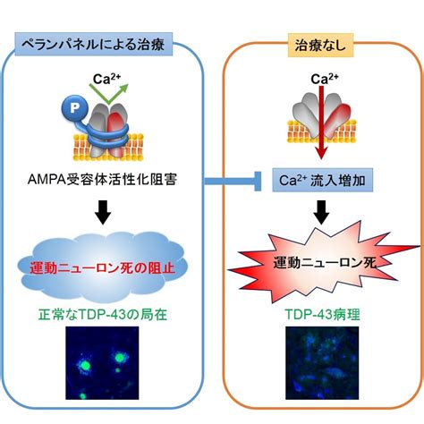 筋萎縮性脊髄側索硬化症 Japaneseclassjp