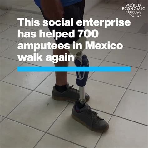 Alain P On Linkedin Amputation Prosthetic Proactible Diabetes Mexico Health