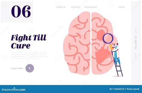 Alzheimer And Dementia Disease Symptoms Memory Loss Problem Website