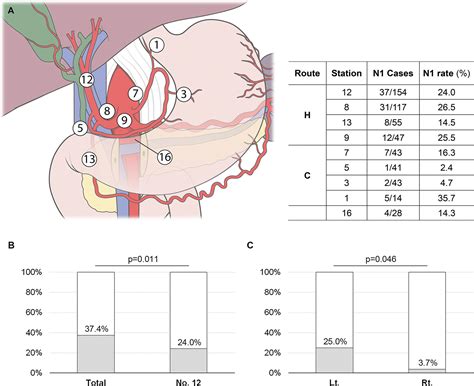 Extent Of Lymph Node Dissection For Accurate Staging In Intrahepatic Cholangiocarcinoma