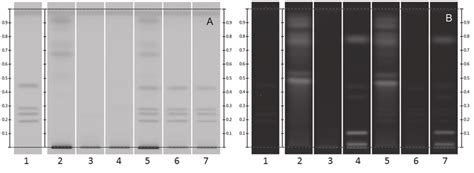 Hptlc Profiles Under 254 Nm Uv Light A And 366 Nm Uv Light B 1