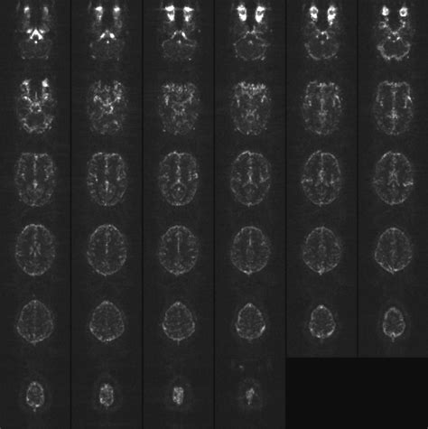 PractiCal FMRI The Nuts Bolts Understanding FMRI Artifacts Good Axial Data