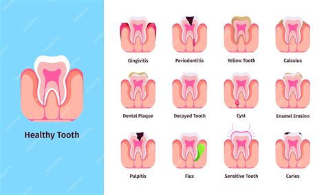 Premium Vector Teeth Problems Medical Infographic Illustrations With