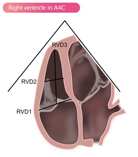 Standard Transthoracic Echocardiogram Complete Imaging Protocol Ecg