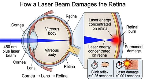 High Power Blue Laser Dangers Class 4 Laser Safety Guide 2026