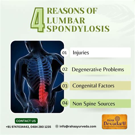 Lumbar Spondylosis Understanding The Causes And Symptoms