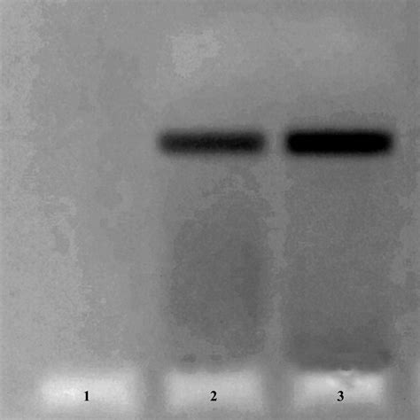 Hla B27 Dna Mutation Study In Rajkot Id 7937712997