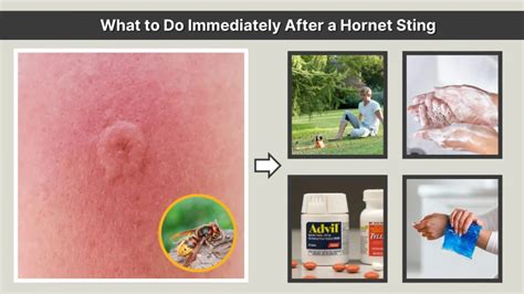 Are Hornets Dangerous Everything You Need To Know