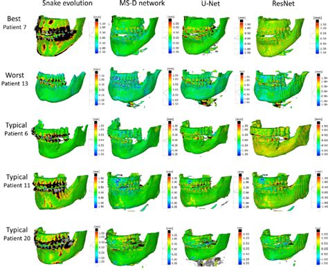 Color Maps Of The Surface Deviations Of Five Standard Tessellation