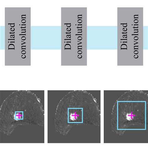 Top Architecture Of The Dilated Convolutional Neural Network 19 The