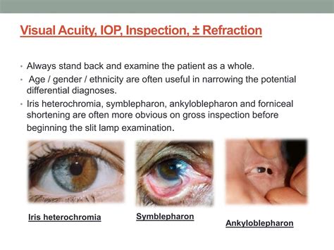 Anterior Segment Examination Pptx Ppt