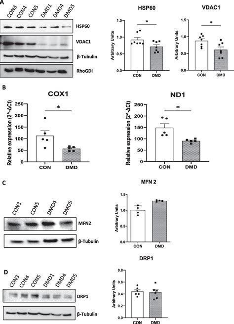 Ipsc Derived Cardiac Fibroblasts From Dmd Patients Showed A Reduced