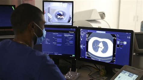 Lung Cancer Screening Guidelines Updated By American Cancer Society