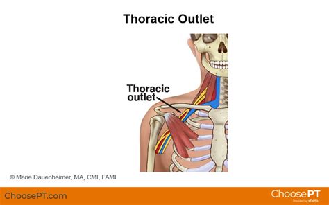 Thoracic Outlet Syndrome Anatomy