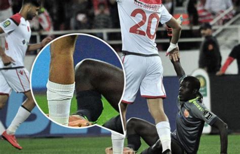 La nature de la blessure de Khadim Ndiaye connue Il sera éloigné des