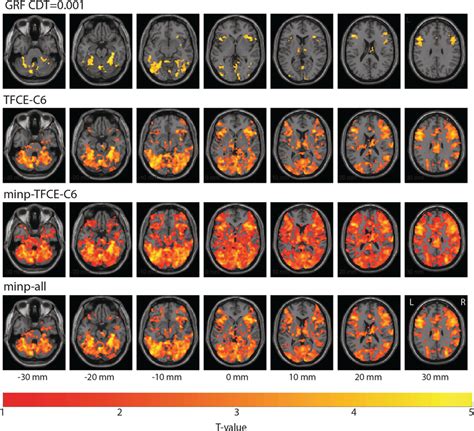 Analyses Of Real Task Functional Magnetic Resonance Imaging Fmri Download Scientific Diagram