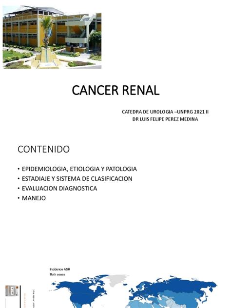 Cáncer Renal Pdf Cáncer Metástasis