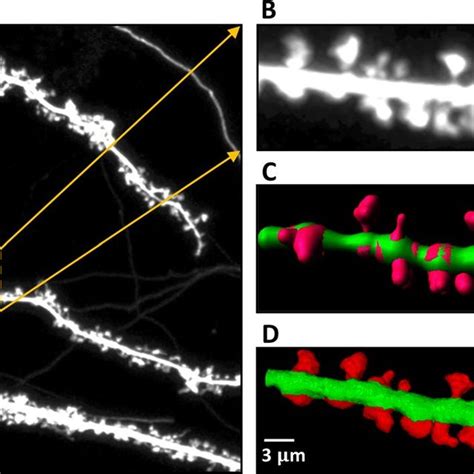 Segmentation Of Dendritic Spines From Complex Dendritic Tree In Brain