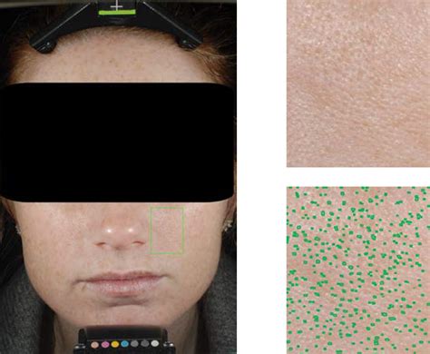 Smart Segmentation — Media Cybernetics Image Analysis Forums
