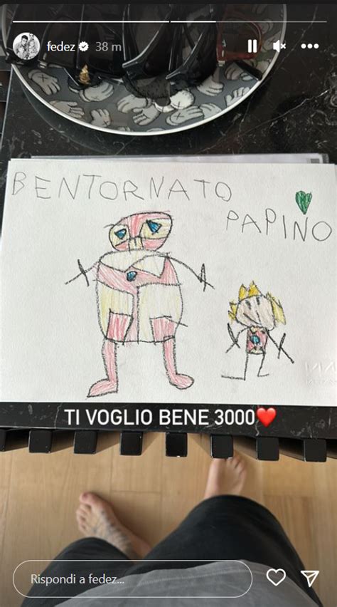 Fedez è stato dimesso dall ospedale è ora a casa FOTO