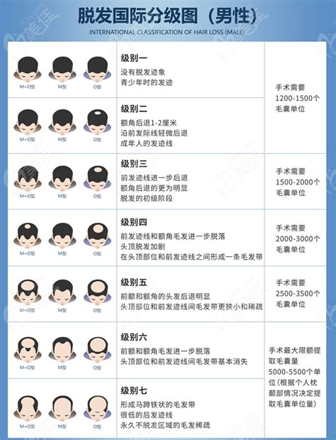详解轻中度的m型发际线植发各需要多少个毛囊多少钱 美佳社区