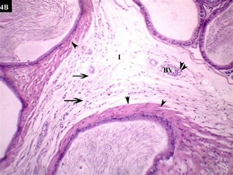 4a Section Of The Cauda Epididymis Of Bisphenol A Treated Group Iii