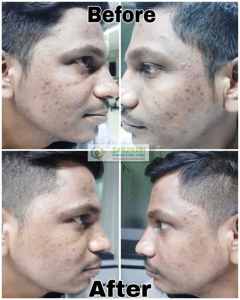 Sanjivani Homeopathic Clinic In Bhimradsurat Book Appointment Online
