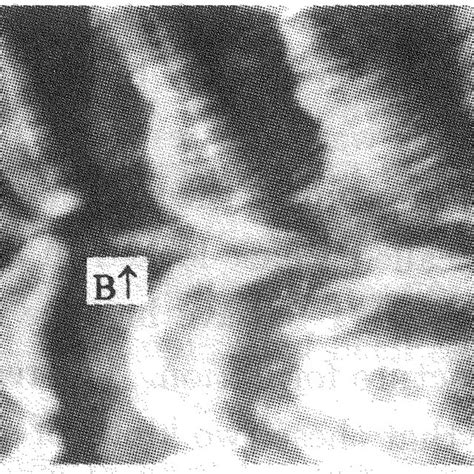 long streak b↑ in a transitional boundary layer ratio 1 5 x from