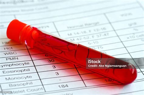 Sampel Darah Lengkap Dan Hasil Tes Darah Konsep Kesehatan Dan Medis