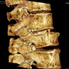 LWK - DocCheck Flexikon