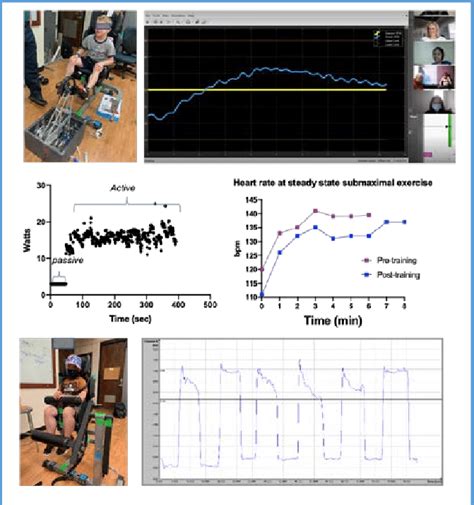 Upper Panel Boy With Dmd On Motorized Ergometer With Feedback