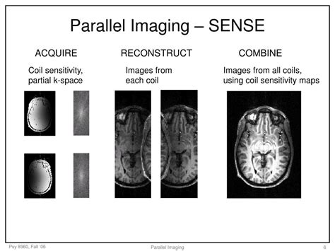 Ppt Parallel Imaging Powerpoint Presentation Free Download Id 1298946
