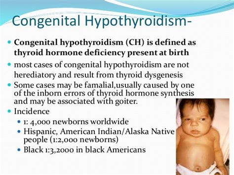 Congenital Hypothyroidism