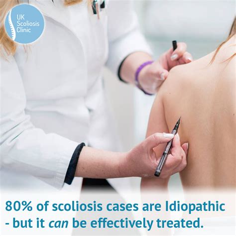 Idiopathic Scoliosis Clinic Uk Treating Scoliosis Without Surgery