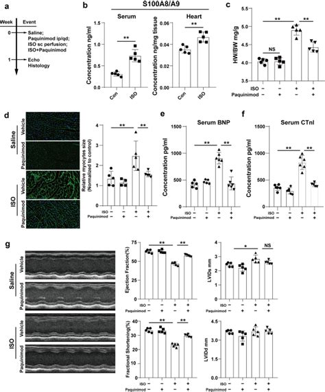 靶向 S100a9 可预防 β 肾上腺素能激活引起的心脏损伤 Inflammation X Mol