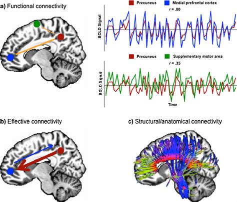Models Of Brain Connectivity Sketches Illustrate A Functional Download Scientific Diagram