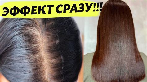 Всего 2 мощных ингридиента и ВОЛОСЫ растут как Сумасшедшие ОТВАР СПАС
