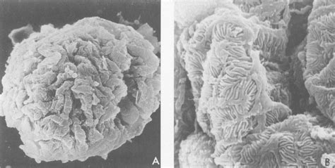 A Scanning Electron Microscopy Sem Of Isolated Cellular Glomerulus Download Scientific