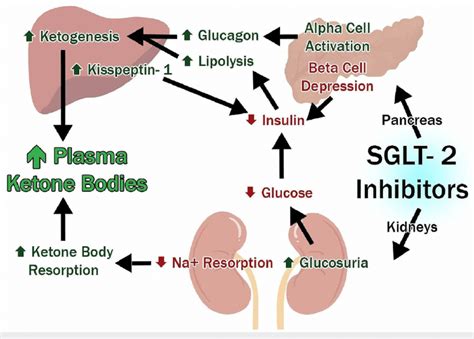Sglt2 Inhibitorinduced Euglycemic Diabetic Ketoacidosis
