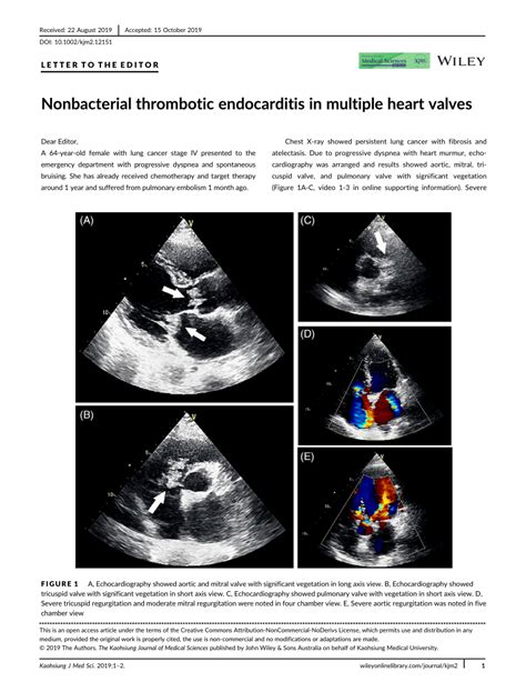 Pdf Nonbacterial Thrombotic Endocarditis In Multiple Heart Valves