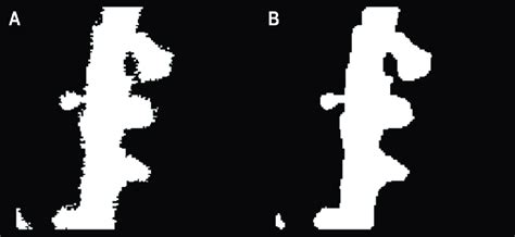 Surface Smoothing Of Binary Image A Initial Binary Image Contains A