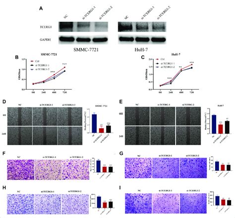 Knockdown Of Tcerg1 In Hcc Cell Suppresses Proliferation Migration And