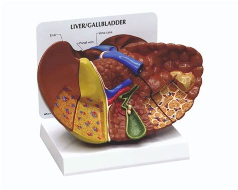 Pvc Liver Diseased Model Rh 3310 At Best Price In Pune Id 2855059697033