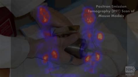 Pet Scan Youtube