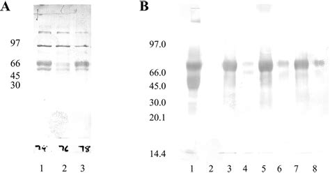 Figure 2 From Streptococcus Iniae Expresses A Cell Surface Non Immune Trout Immunoglobulin