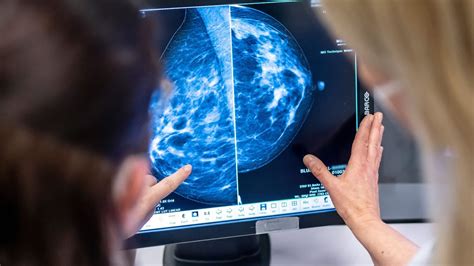 Gesundheit Vorbeugendes Mittel gegen Brustkrebs für britische Frauen