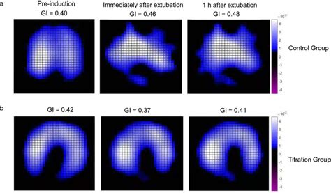Representative Images Showing Tidal Variation Measured By Electrical
