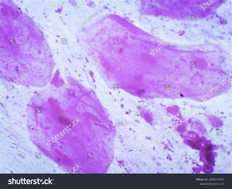Gram Stain Gram Positive Cocci Gram Stock Photo Shutterstock